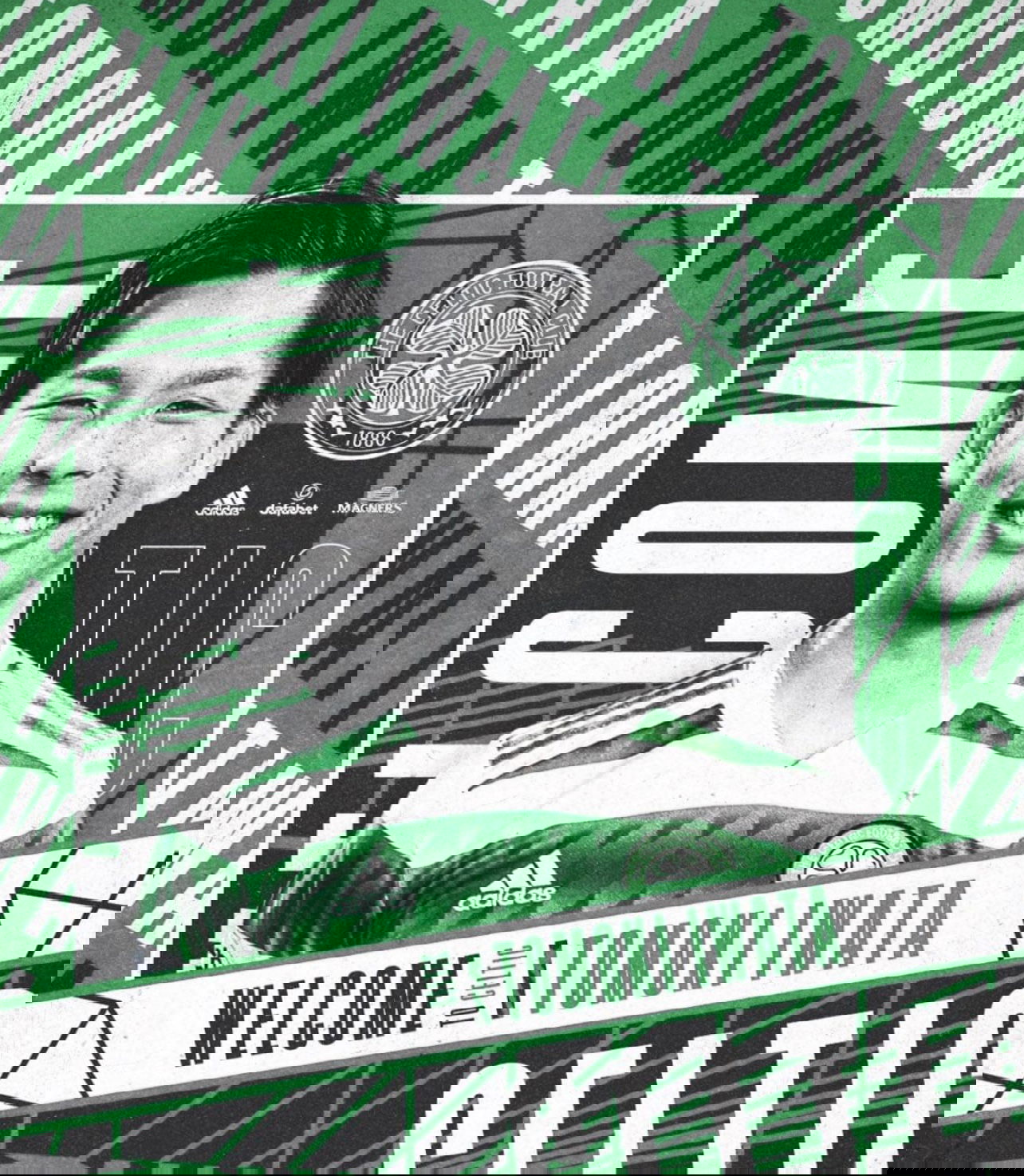 Tomoki Iwata Signs For Celtic; Deal Structure | Latest Celtic News