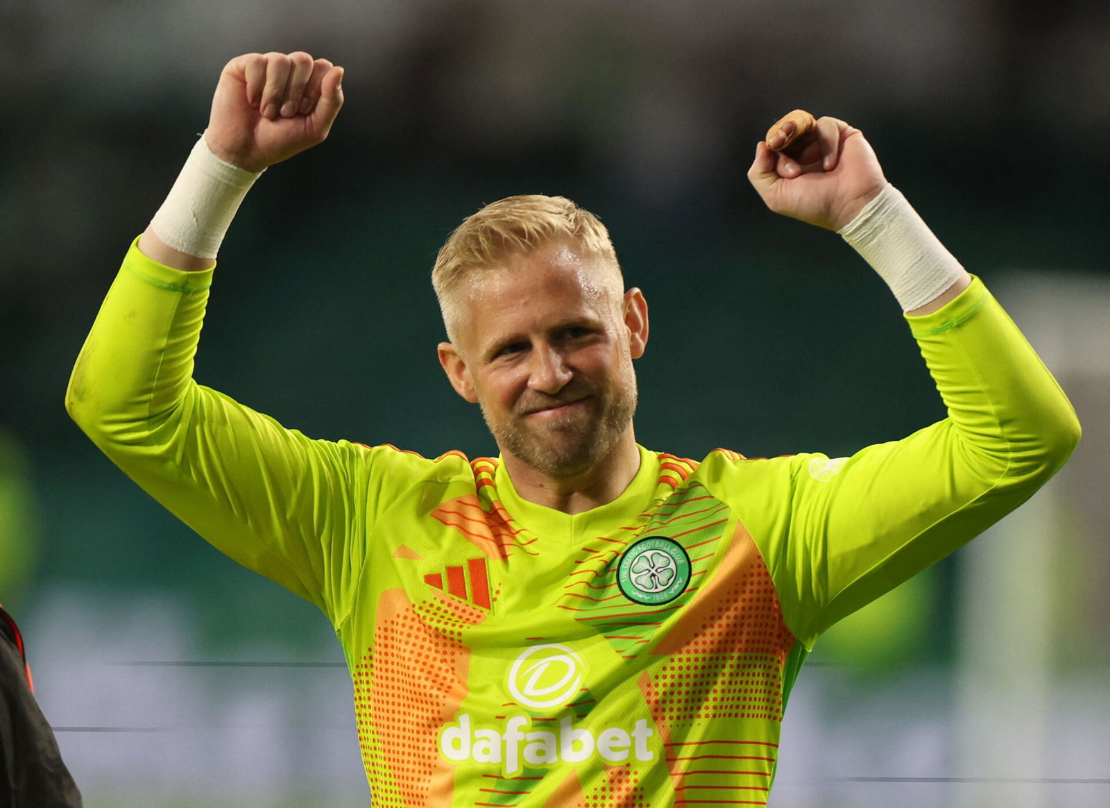 The 'Completely Different' Celtic Aspect Kasper Schmeichel Finds 'Super ...